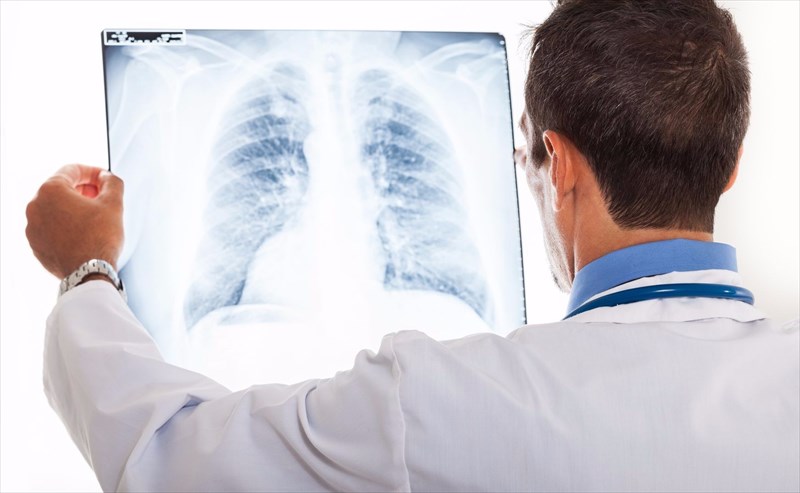 Diagnosing pneumonia Diagnosing pneumonia